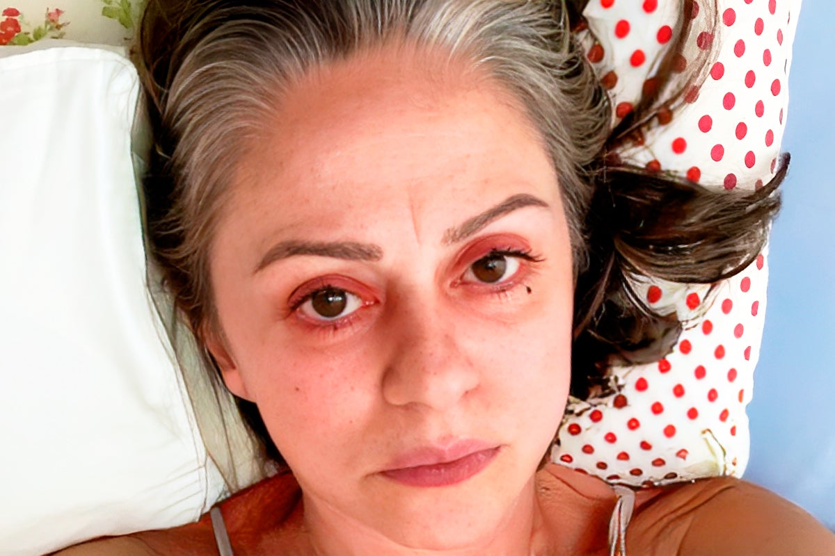 Doença, falência e desprezo: três astros que sumiram após A Grande ...